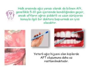 Aft Nedir ve Nasıl Geçer? - Dr. Tuncay Akdoğanlı